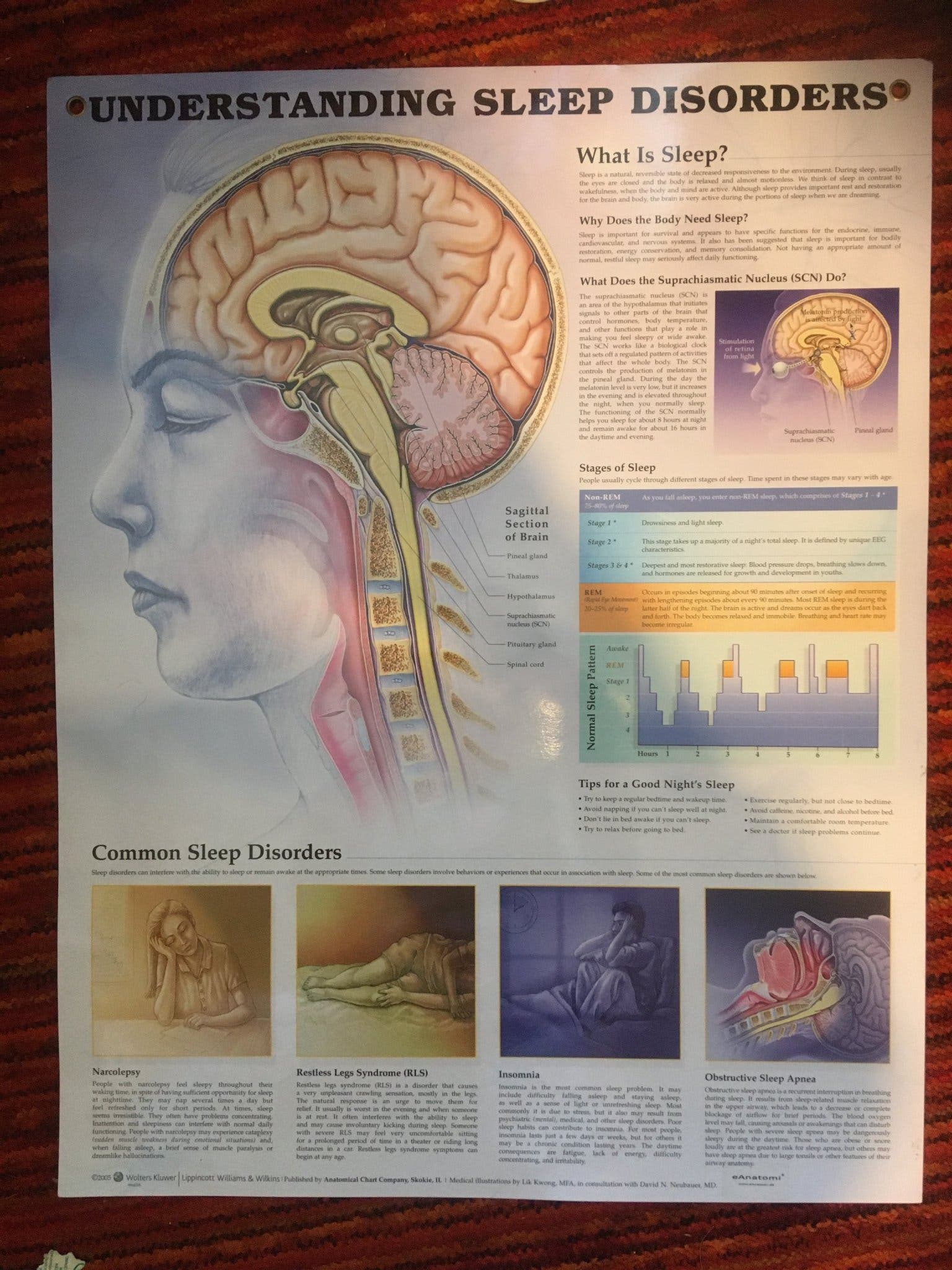 Plansch: Understanding sleep disorders | Köp på Tradera (646834329)
