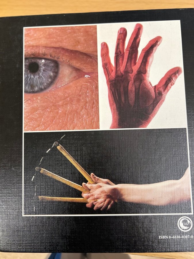 Color Atlas of Surface Anatomy av Kenneth M. Ba.. | Köp på Tradera ...